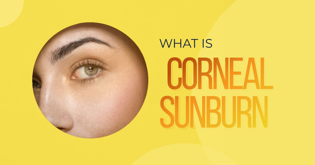Have you ever heard about corneal sunburn? - Global Eye Hospital