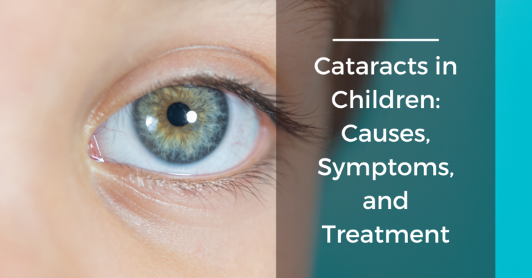 Congenital Cataracts: Symptoms, Causes, And Treatment – YOFR