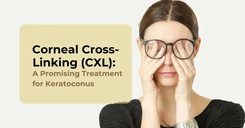 Corneal Cross-Linking (CXL) for Keratoconus Treatment